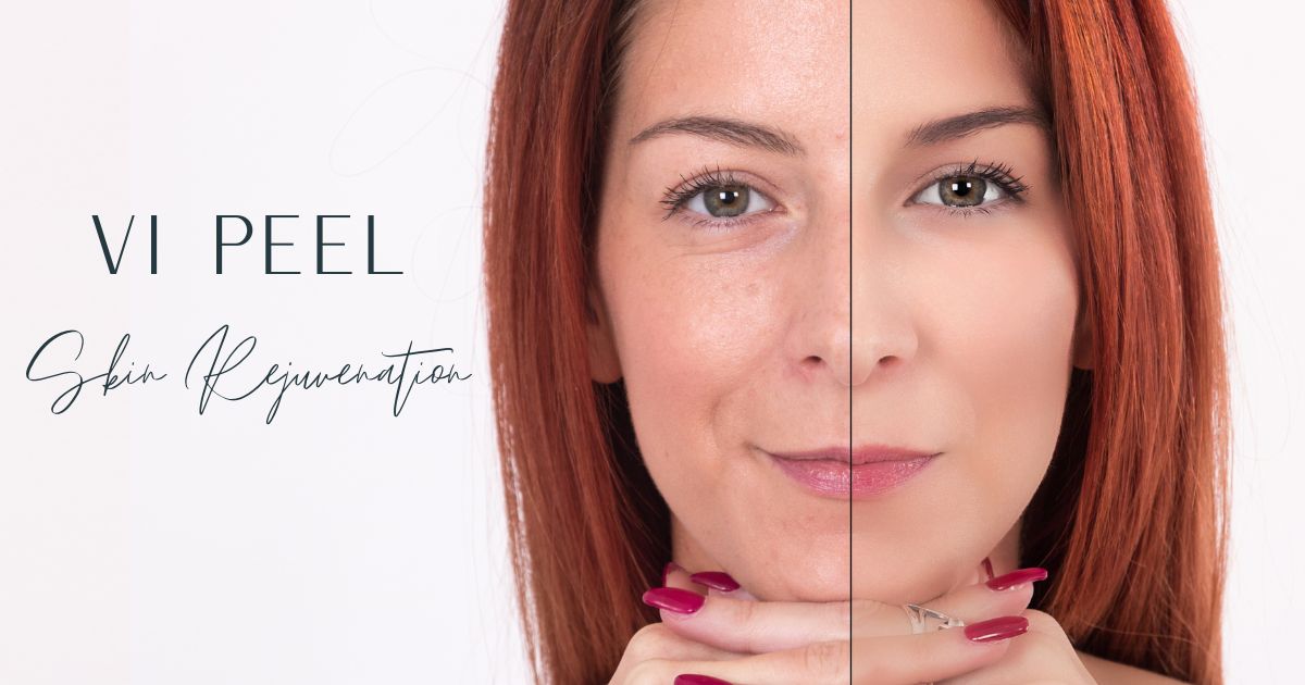 How VI Peel Precision Plus Revolutionizes Skin Rejuvenation for a Heal